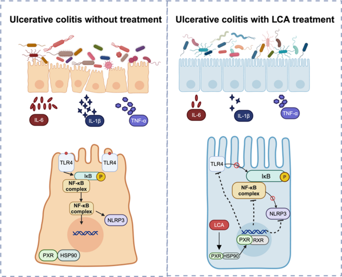 Lithocholic acid ameliorates ulcerative colitis via the PXR/TLR4/NF-κB ...