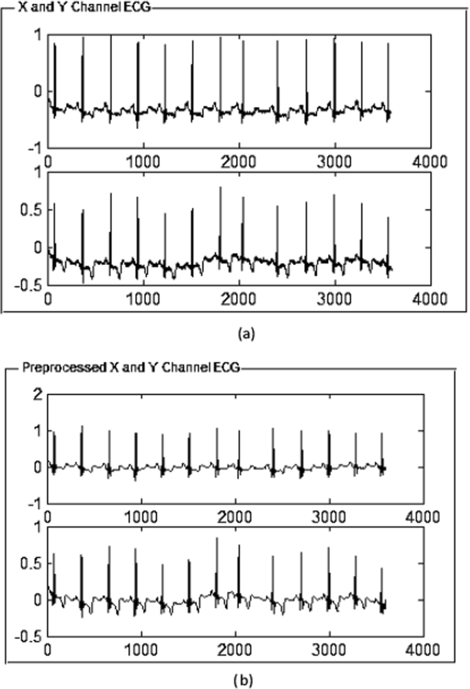 An ECG Signal Classification System Using EMD and Pipelined Yolo Network | Circuits, Systems ...