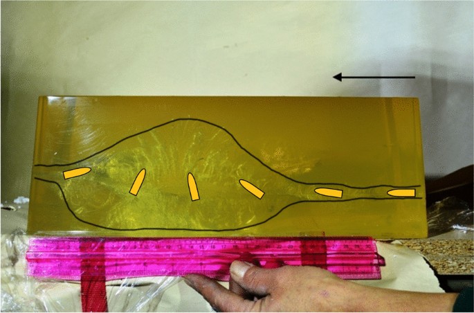 Assault rifle injuries in civilians: ballistics of wound patterns ...