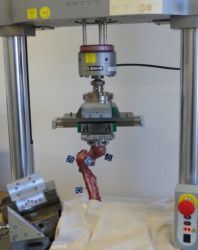 Impact of lateral cortical notching on biomechanical performance in ...