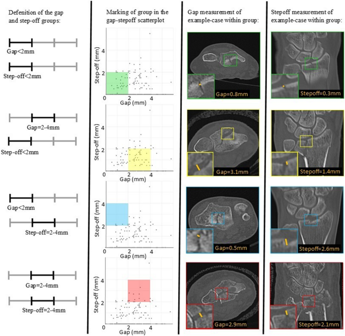 Long-term patient-reported outcomes after nonoperative treatment of ...