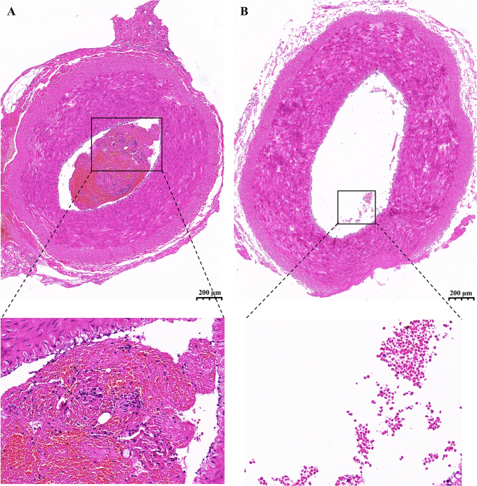Application and observation of hemostatic effect of independently ...