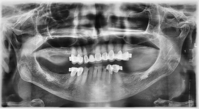 Vorbereitung auf die Facharztprüfung HNO | HNO