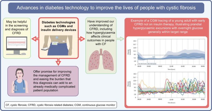 Advances in diabetes technology to improve the lives of people with ...