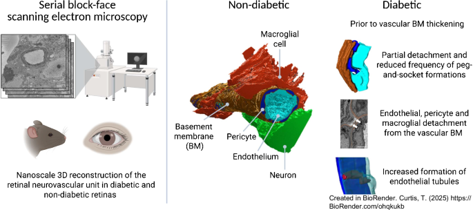 3D electron microscopy reveals novel ultrastructural changes in the ...