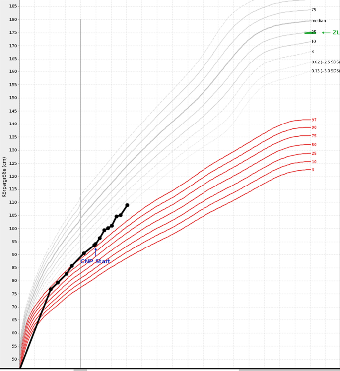 Achondroplasie | Die Orthopädie
