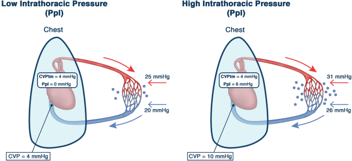 The forgotten relevance of central venous pressure monitoring ...