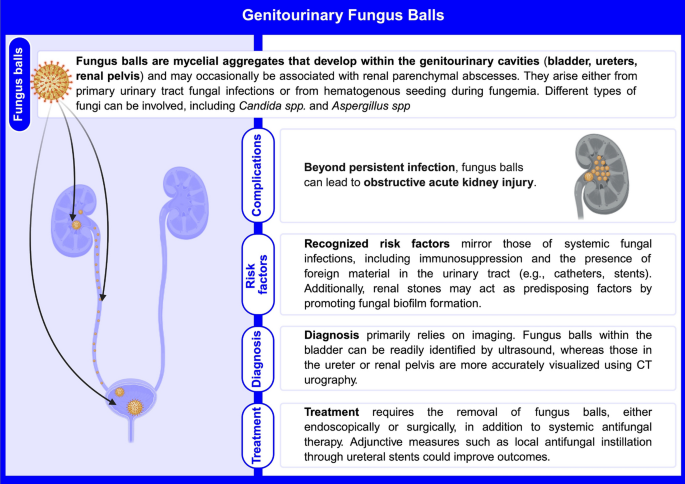 Urinary tract fungus balls in an immunocompromised patient with ...