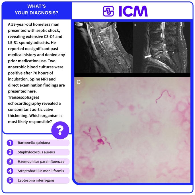 Septic shock secondary to a rat-bite fever | Intensive Care Medicine ...