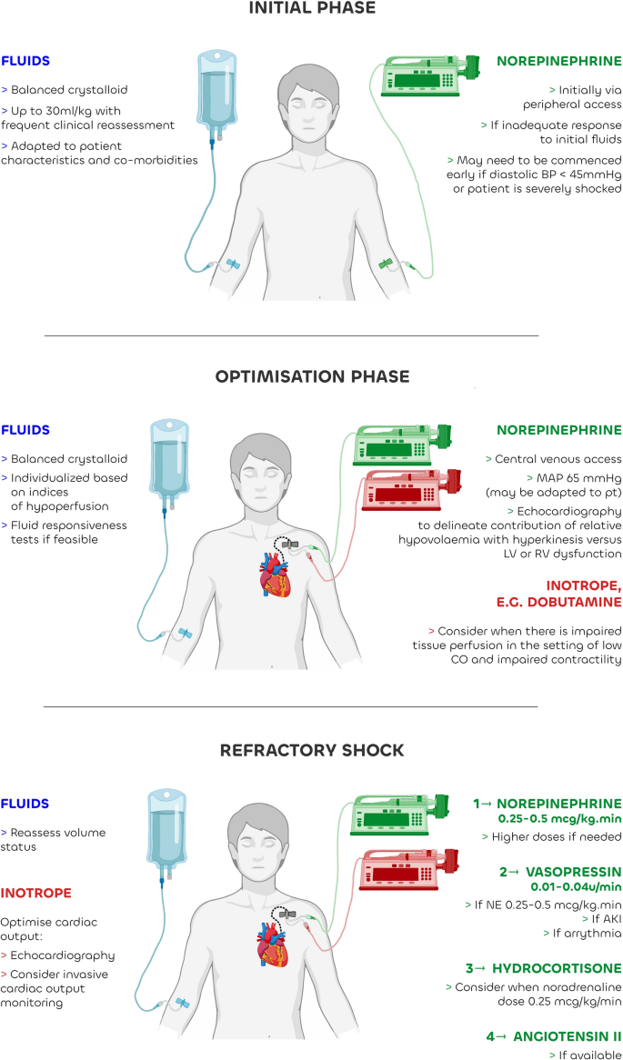 Current standard of care for septic shock | Intensive Care Medicine