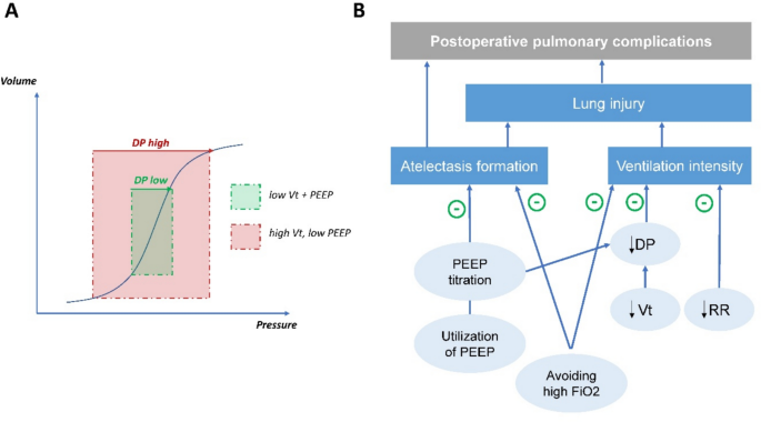 How to set the ventilator during surgery? Key principles to guide ...
