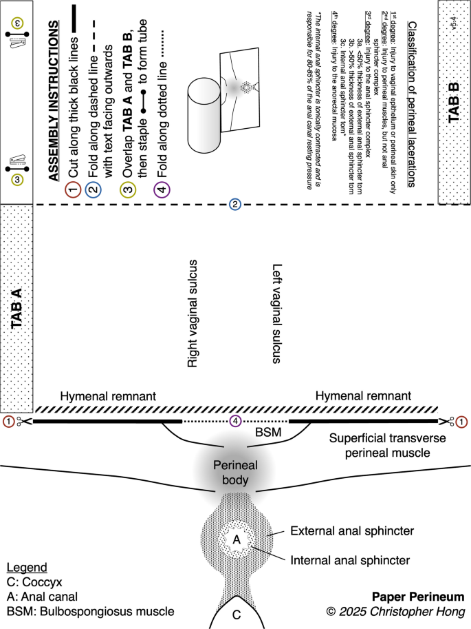 The Paper Perineum Model: An Accessible Three-Dimensional Model for ...