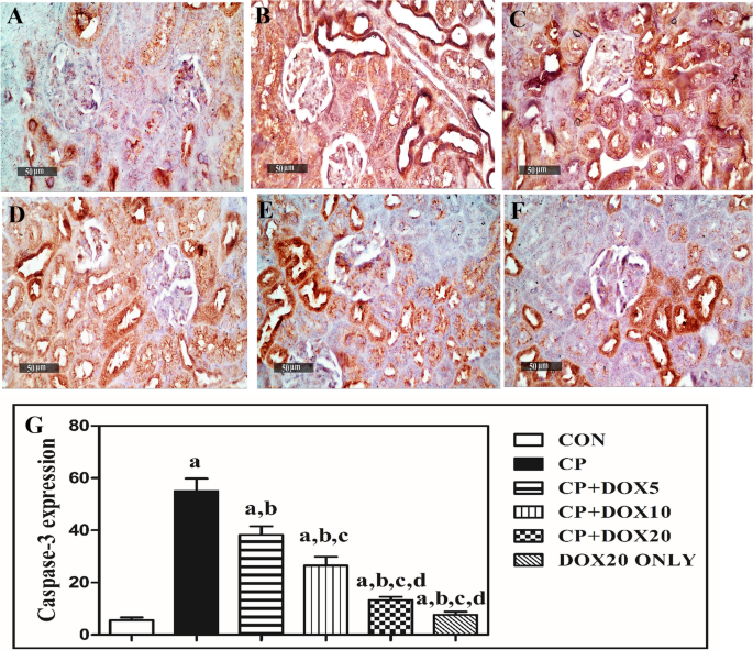 Doxepin as OCT2 inhibitor ameliorates inflammatory response and ...