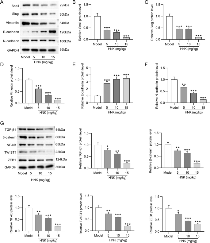 Honokiol inhibits cell migration and invasion by blocking EMT via Snail ...