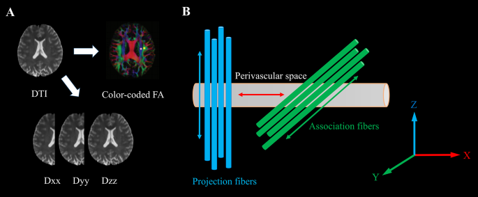 Decreased DTI-ALPS index in delirium: a preliminary MRI study ...