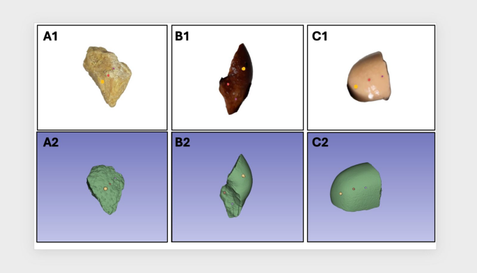 In vitro comparative analysis of ablation volume and energy ...