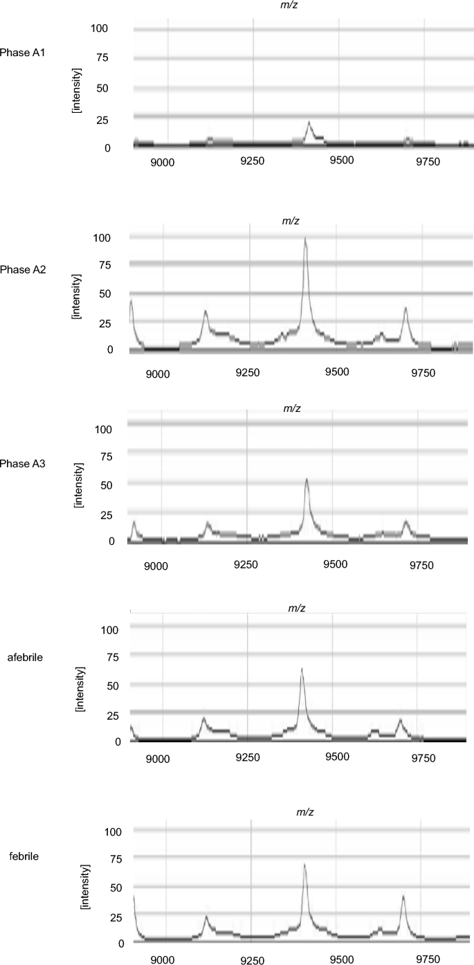 Decreased Serum Apolipoprotein CIII in the Acute Phase of Kawasaki ...