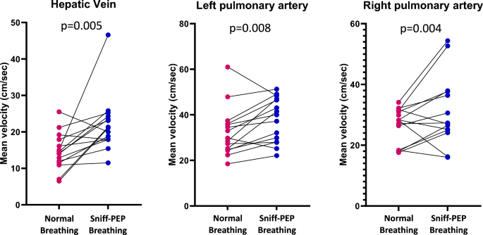 Augmented Biphasic Breathing Using Sniff and an Oral Positive ...