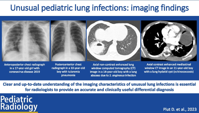 Unusual pediatric lung infections: imaging findings | Pediatric Radiology