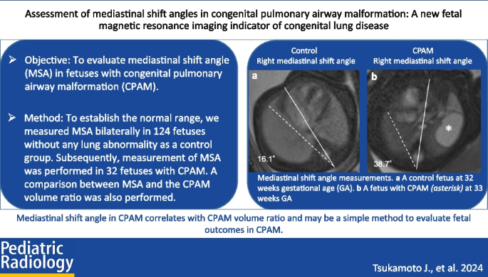 Assessment of mediastinal shift angles in congenital pulmonary airway ...