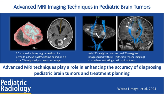 Advanced MRI imaging techniques in pediatric brain tumors | Pediatric ...