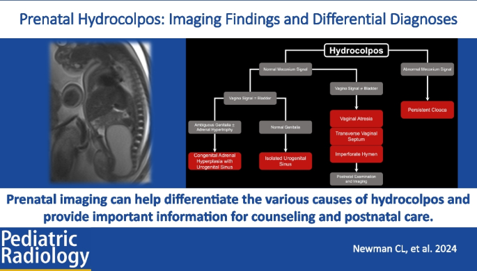 Prenatal hydrocolpos: imaging findings and differential diagnosis ...