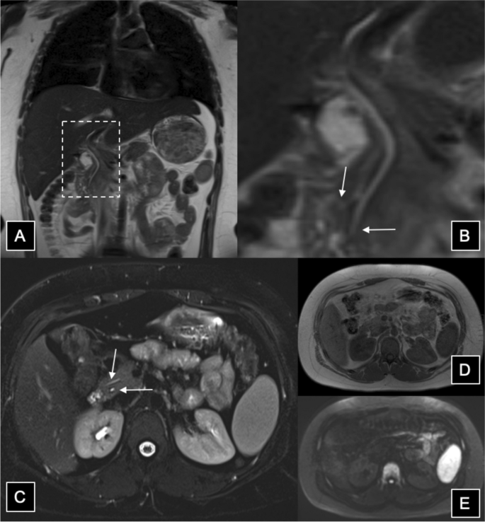 International standardization of pediatric magnetic resonance imaging ...