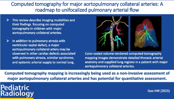Computed tomography for major aortopulmonary collateral arteries: a ...