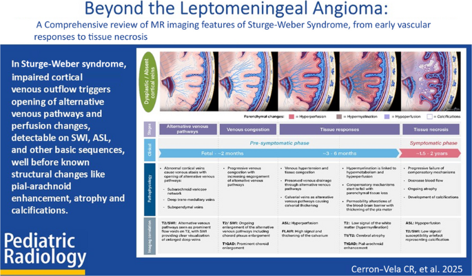 Beyond the leptomeningeal angioma: a comprehensive review of MR imaging ...