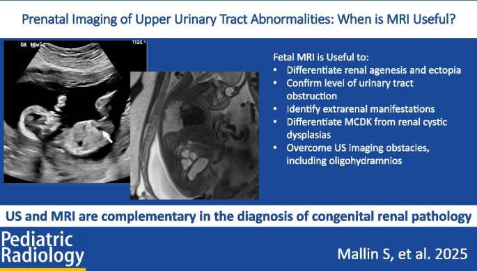 Prenatal imaging of upper urinary tract abnormalities: when is MRI ...