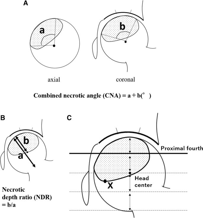 Can necrotic depth be a substitute of necrotic volume to predict ...
