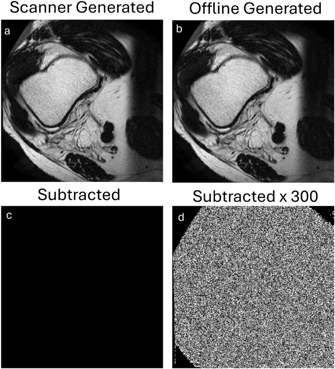 Improving tissue contrast visualization in two-point Dixon MRI using ...
