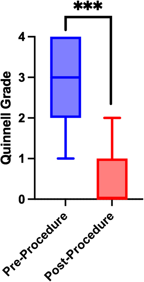Outcomes of percutaneous ultrasound-guided A1 pulley fenestration ...
