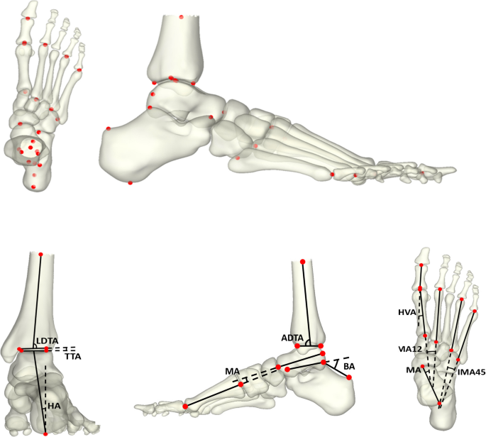 Quantifying 3D foot and ankle alignment using an AI-driven framework: a ...