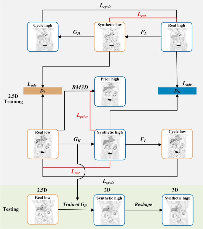 IE-CycleGAN: improved cycle consistent adversarial network for unpaired ...