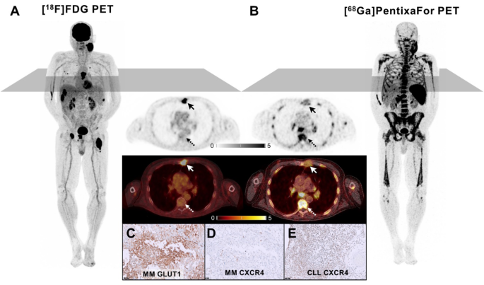Disclosing tumor biology by means of molecular imaging in a patient ...