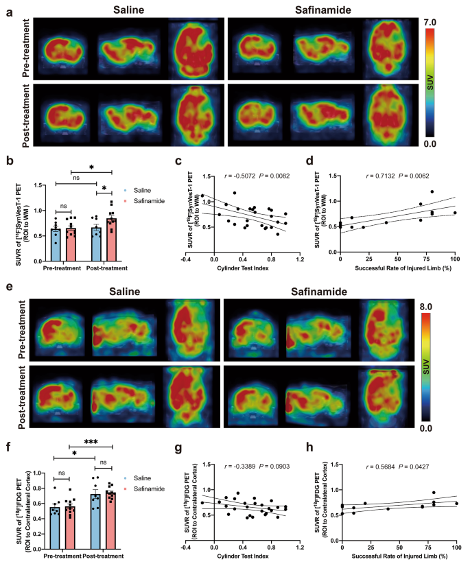 PET imaging of synaptic vesicle glycoprotein 2 subtype A for ...