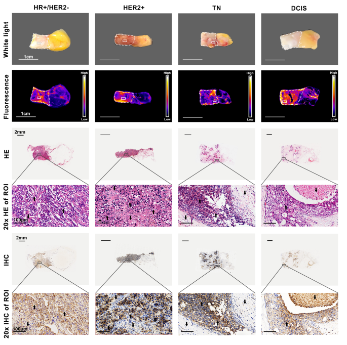 GLUT1 as a generic biomarker enables near-infrared fluorescence ...