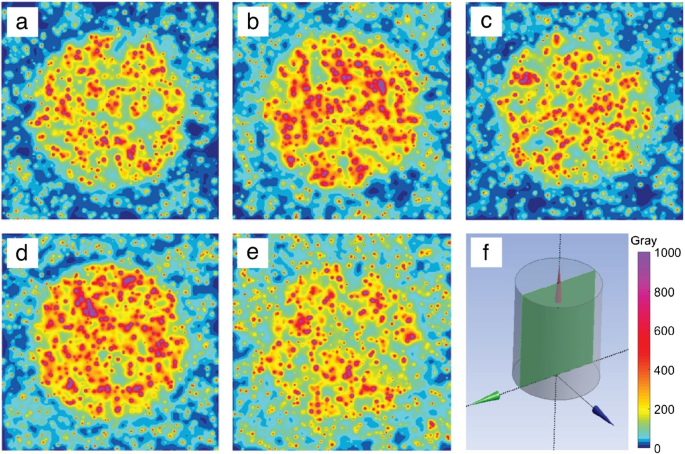The relationship between yttrium-90 glass microspheres specific ...