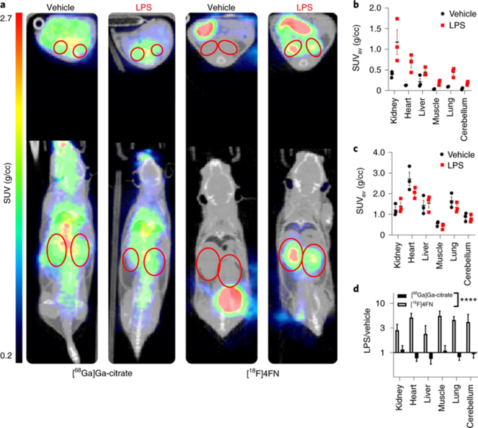 Advances in PET imaging of oxidative stress: tracer innovation ...