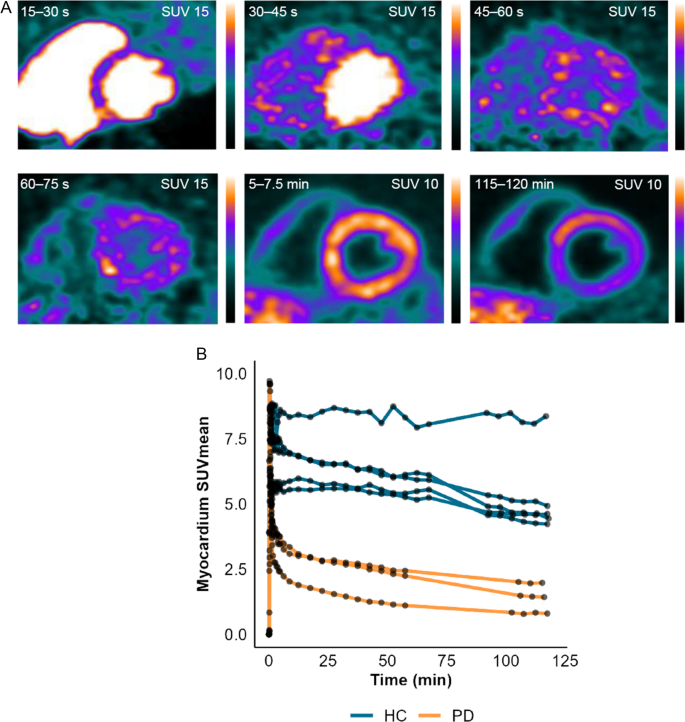 [18F]MFBG PET/CT imaging of myocardial sympathetic innervation in ...