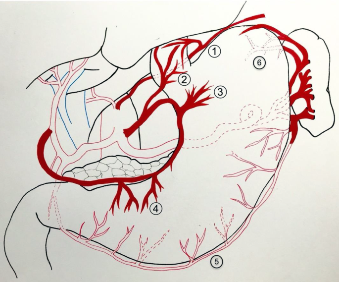 Assessment of arterial supply to the stomach after bariatric surgery ...