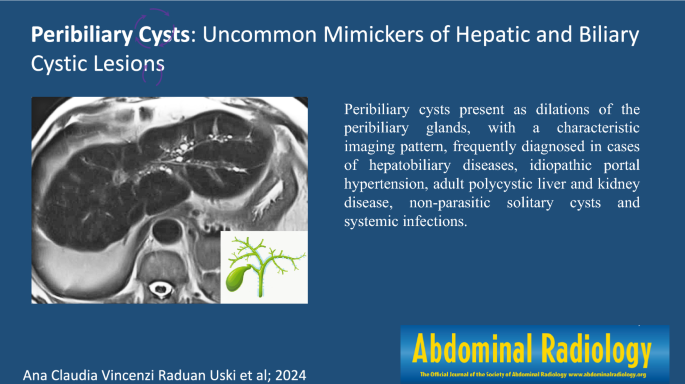 Peribiliary cysts: uncommon mimickers of hepatic and biliary cystic ...
