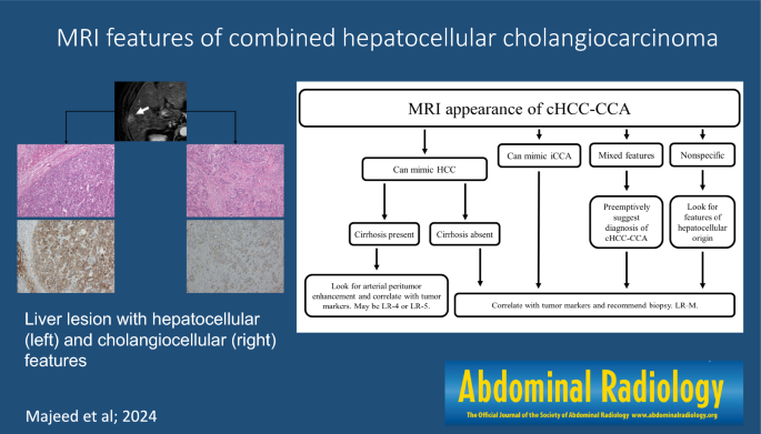 MRI features of combined hepatocellular-cholangiocarcinoma | Abdominal Radiology