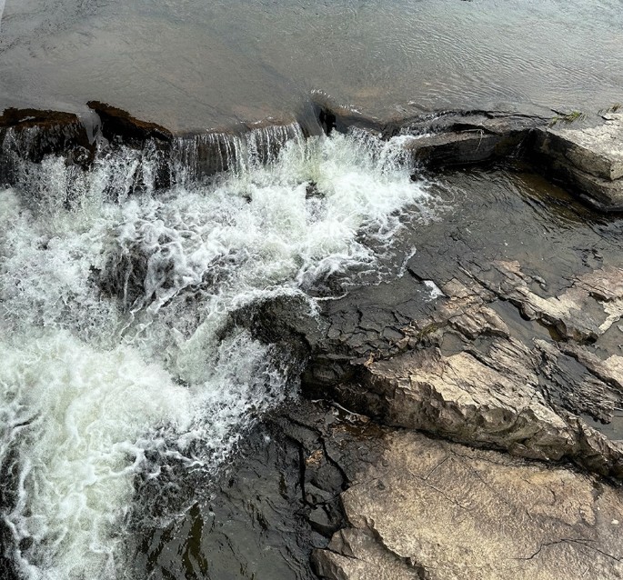 Cascade (cup and spill) stomach | Abdominal Radiology