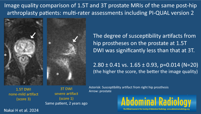 Image quality comparison of 1.5T and 3T prostate MRIs of the same post-hip arthroplasty patients ...