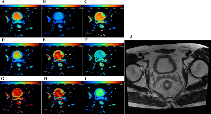 Predictive value of mono-exponential and multiple mathematical models ...