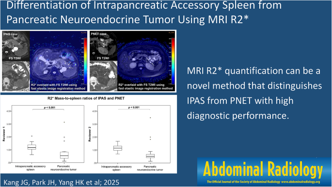 Differentiation of intrapancreatic accessory spleen from pancreatic ...