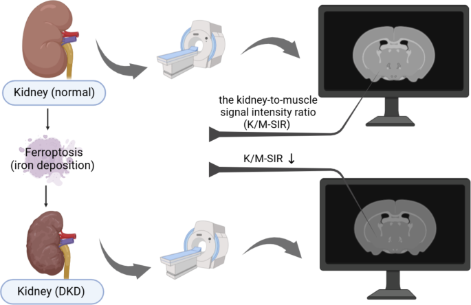 Evaluation of iron deposition in diabetic kidney disease using the kidney-to-muscle signal ...