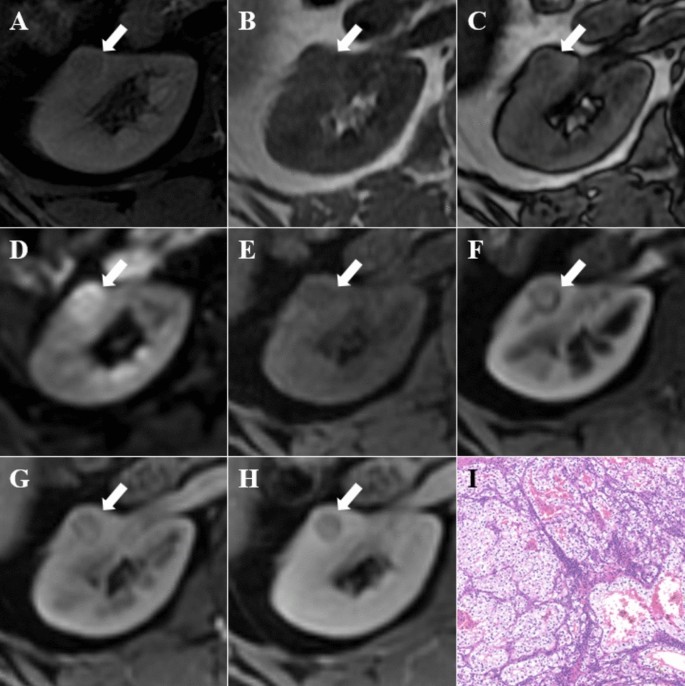 A simple method based on qualitative MRI features for characterizing ...